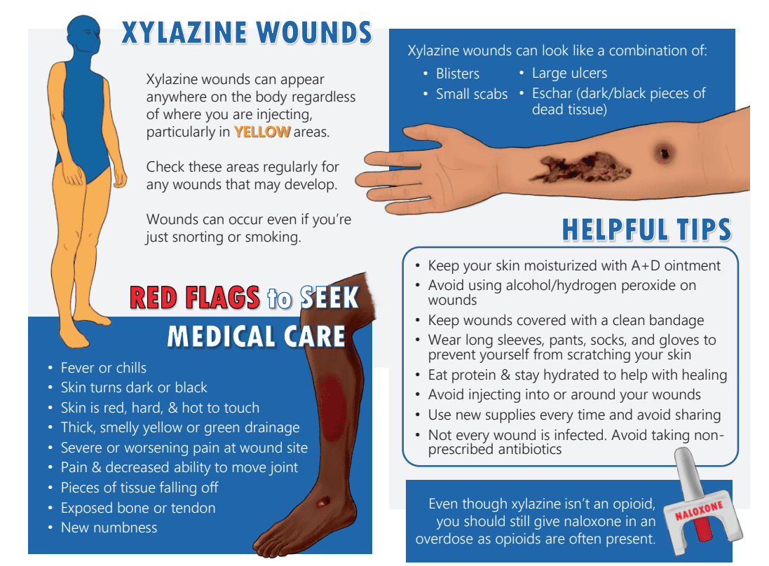 Tranq Drug Facts And Warnings |ARC